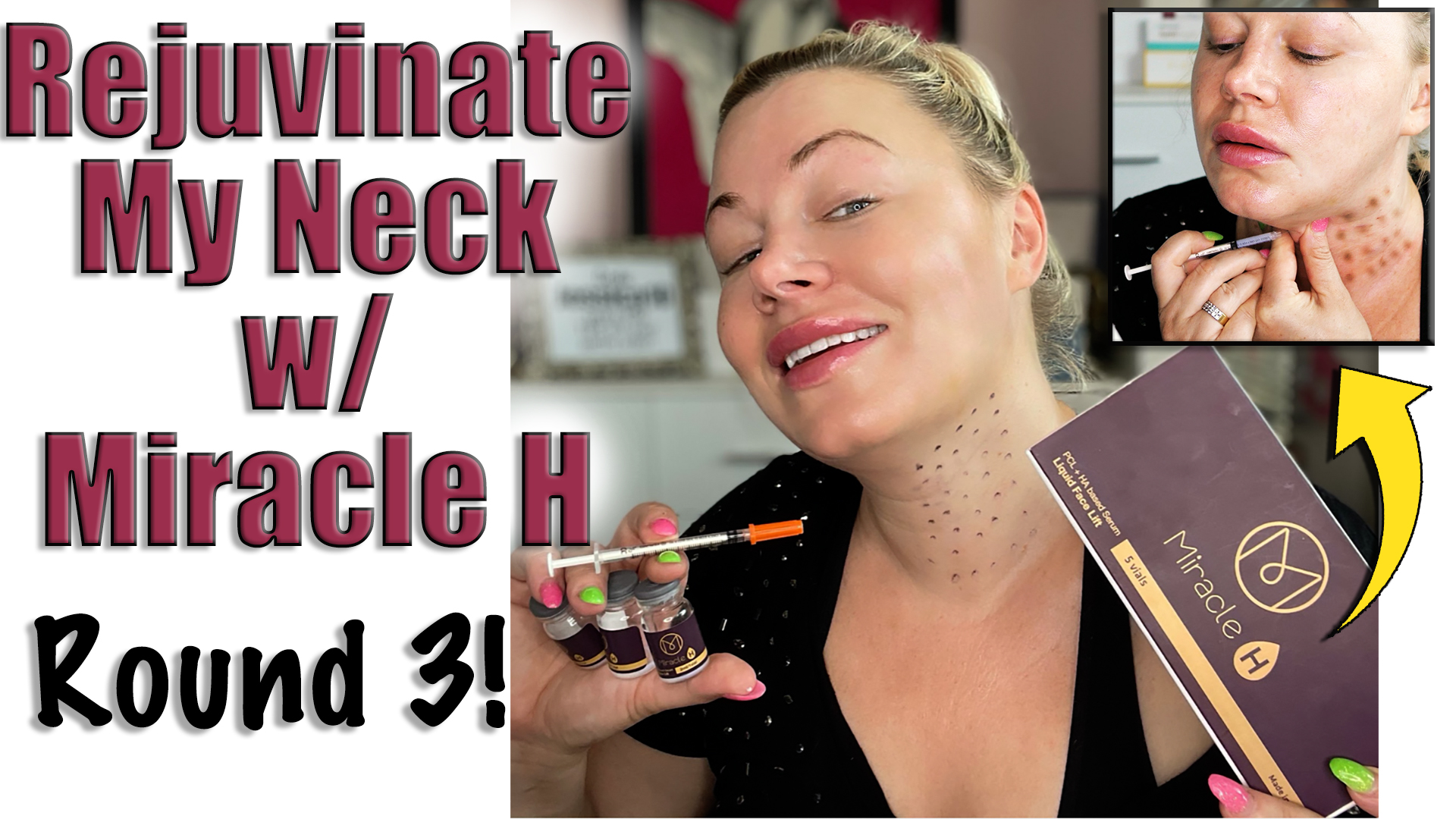 Biostimulators | Liquid PCL | Facelift in a bottle